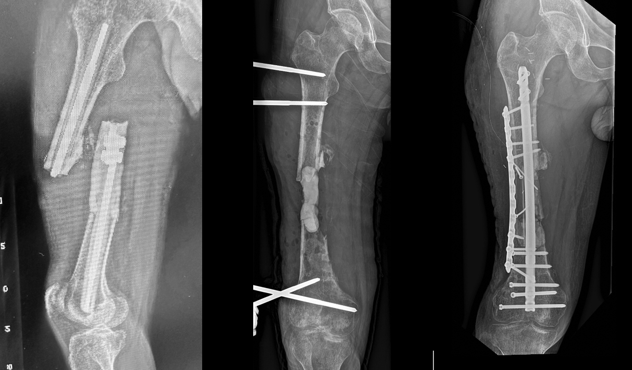 Reconstructieve chirurgie – Plastic Surgery Amsterdam UMC